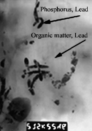 Rhizopus Oryzae Extract 100 Mgml Injectable Solution Semantic Scholar