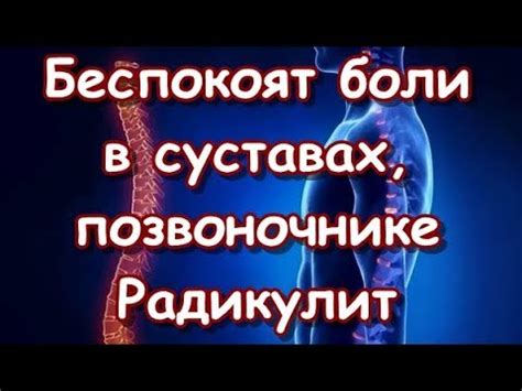 Беспокоят боли в суставах, позвоночнике - Радикулит - YouTube