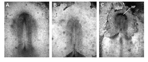 Forces That Create The Hf Are Ectodermal In Origin The Ectoderm Was