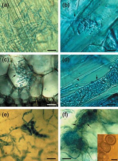 Microscopic Appearence Of Ustilago Maydis Growing Into The Plant