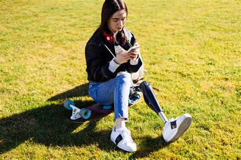 의족을 착용한 젊은 여학생이 대학 캠퍼스의 푸른 잔디밭에 앉아 스마트폰을 사용하고 있다 공공 공원에서 생체 공학적 다리를 가진 장애인 여성 보철 장비를 착용한 여성이 전화를