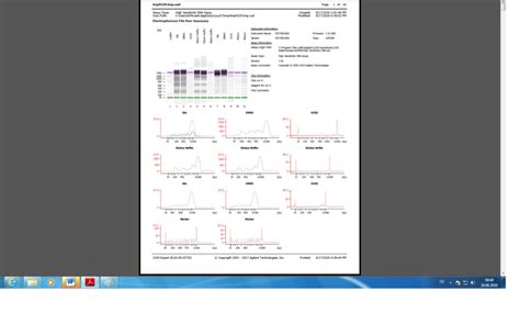 Can Someone Help Me Analysing The High Sensitivity Dna Kit Researchgate