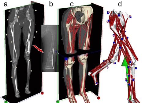 1 Personalized Modeling Workflow For Massive Skeletal Reconstruction Download Scientific
