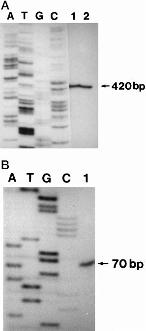 Primer Extension Analysis Mapping Two Major Dmpk Transcription Start