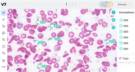 V7 Snaps Up 33m To Automate Training Data For Computer Vision Ai