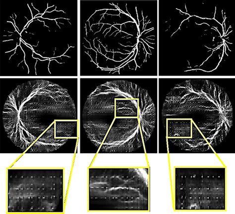 Shows The Blurriness And Dotted Structure In The Generated Images Using