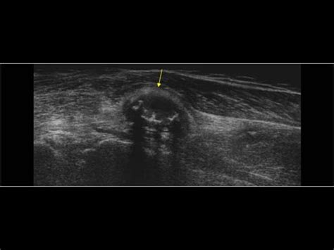 Musculoskeletal Bone Muscle Nerves And Other Soft Tissues 7 1 Bone