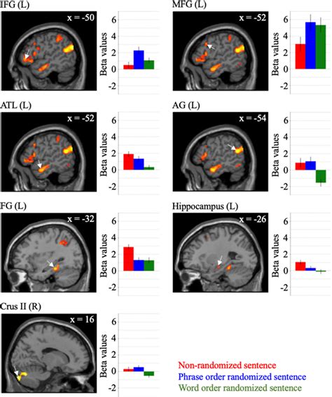 Meaning Processing Dependent Activity In The Semantic Task Based