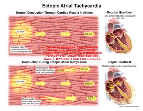 Medical Exhibits Demonstrative Aids Illustrations And Models