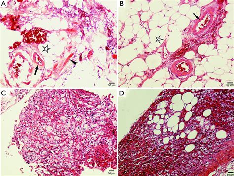 Hematoxylin And Eosin Staining ×100 Showing Large Vascular Spaces Download Scientific Diagram