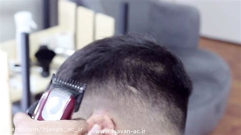 کوتاهی موی سوزنی و لخت