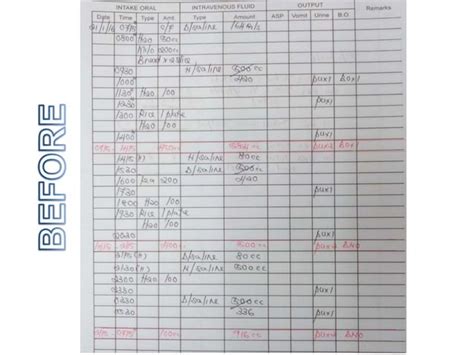 Monitoring Of Intake And Output Pptx Monitoring Of Intake And Output Pptx