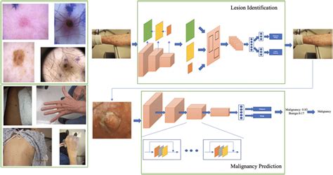 Two Stage Lesion Identification And Malignancy Prediction Framework Download Scientific