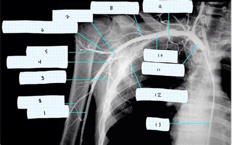 Net Anatomy Exam Ii Flashcards Quizlet