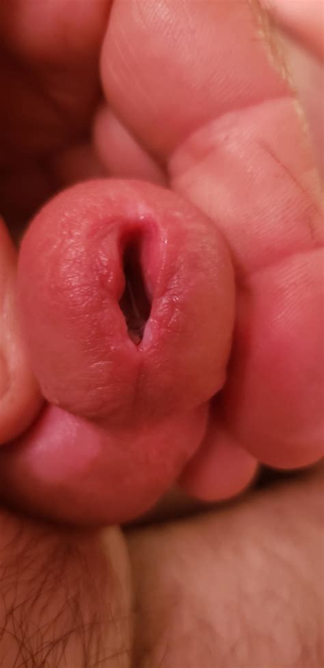 After Sharpie Reddit NSFW