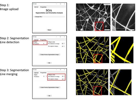 Automatic Identification Of Dendritic Branches And Their Orientation Scientific Article