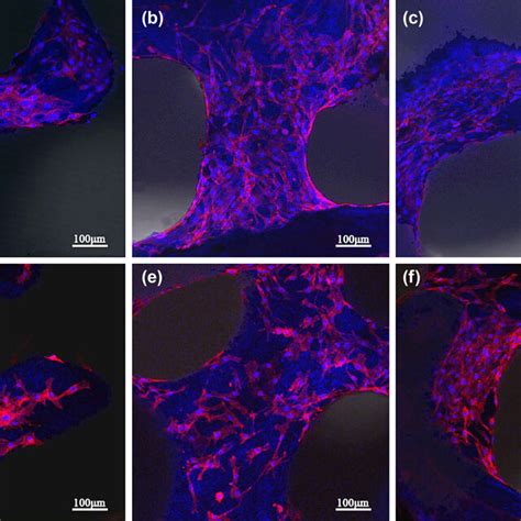 The Microstructure Morphology Of The Bone Slice Under Sem And The