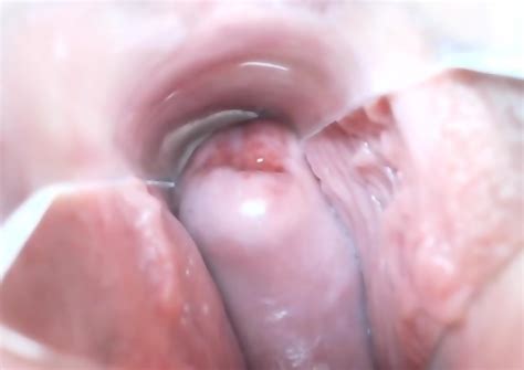 Cervix Present 7 Eporner