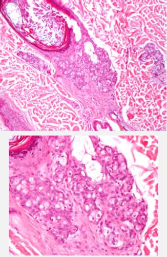 Derm Structure Function Dysfunction Flashcards Quizlet