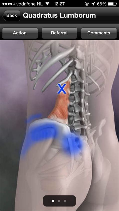 Pin By Jennifer Steffensen Kight On Trigger Points Massage Therapy