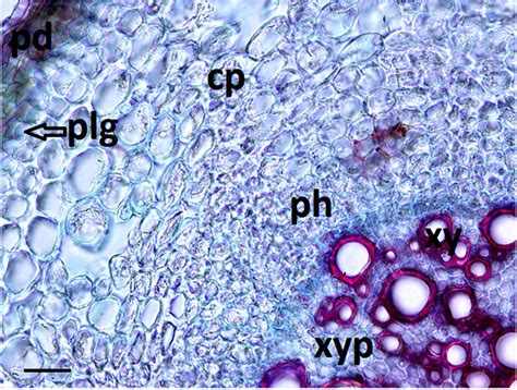 Cross Section Of Root Of Matthiola Anchoniifolia Cp Cortex Download Scientific Diagram