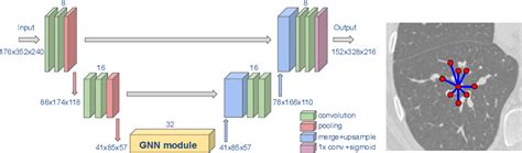 A Joint D UNet Graph Neural Network Based Method For Airway Segmentation From Chest CTs