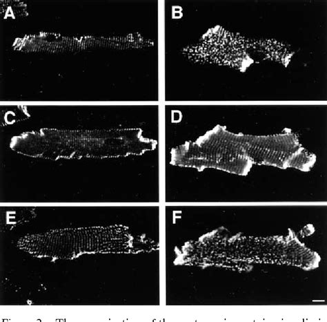 Figure 2 From Alterations At The Intercalated Disk Associated With The