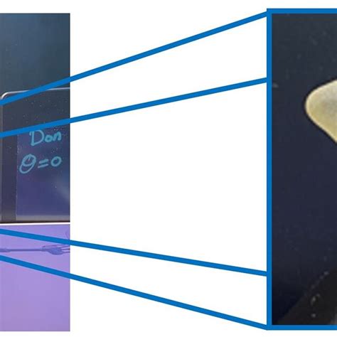 Yolov5 Architecture Used For Penile Area Cropping From Still 2d Images