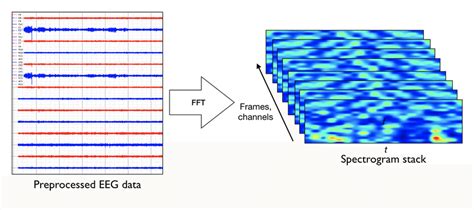 Generation Of Spectrogram Stack For A Subject From Preprocessed Download Scientific Diagram Generation Of Spectrogram Stack For A Subject From Preprocessed Download Scientific Diagram