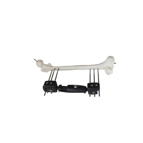 Orthopedic Medical External Fixation Support Peek Target Device