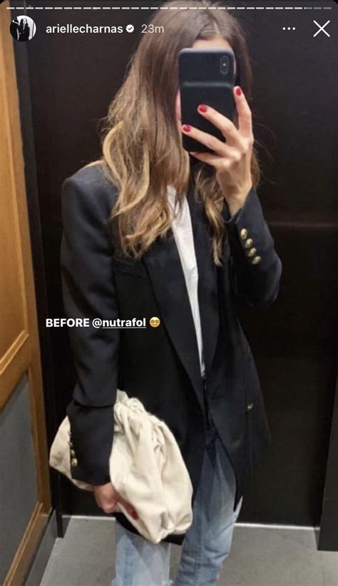 Nutrofol Ad This Before And After Is Just Pathetic Her Hair Hasnt Been That Short In Years Nutrofol Ad This Before And After Is Just Pathetic Her Hair Hasnt Been That Short In Years