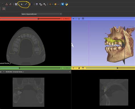 Cbct Parameters Support 3d Slicer Community