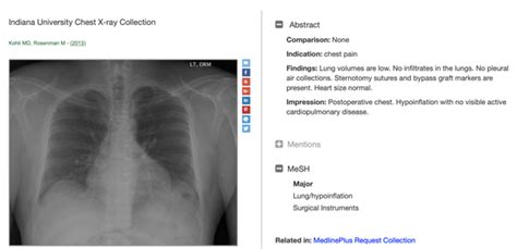论文笔记 On The Automatic Generation Of Medical Imaging Reports 知乎