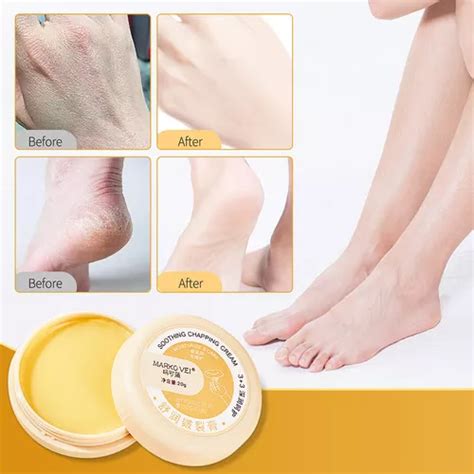 Genérica Cracking Cream Chapping Cream Hand And Foot Antifreeze Foot