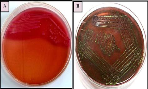 Isolation And Characterisation Of Li Infection From The Bronchial