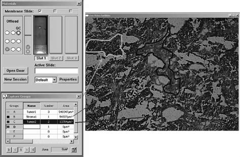 Live Video Microdissection Veritas™ Instruments Have The Capacity To