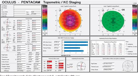 Figure 1 From Keratoconus Progression Classification One Year After Performed Crosslinking