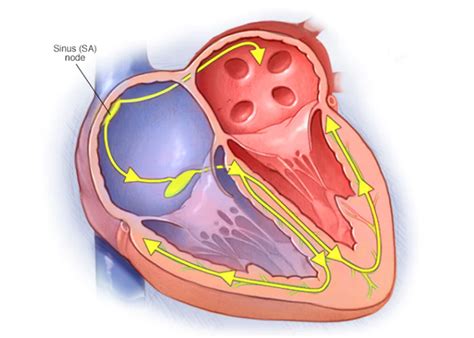 Physiological Pacing In Chennai At Dr Karthigesan Clinic