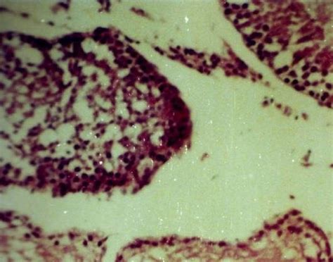 Testes Showing Edema And Degeneration Of Seminiferous Tubules With Download Scientific Diagram