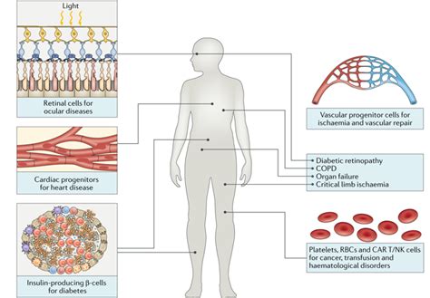Engineering Universal Cells That Evade Immune Detection Nature Reviews