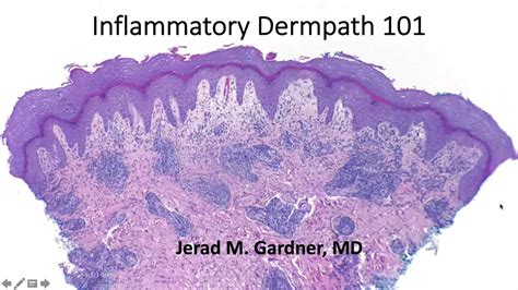 Inflammatory Dermpath 101 A Beginners Guide To Diagnosing Skin Rashes