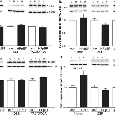 Protein Expression Of Nadph Oxidase Subunit Gp91phox A Sod1 B Sod2 Download Scientific