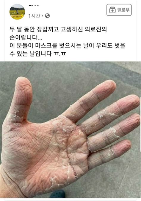 두 달 동안 장갑낀 의료진의 손 보배드림 베스트글