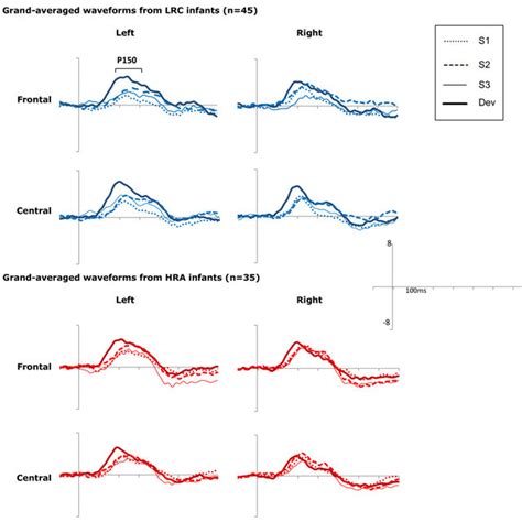 Grand Averaged Waveforms For Lrc And Hra Infants Grand Averaged Download Scientific Diagram