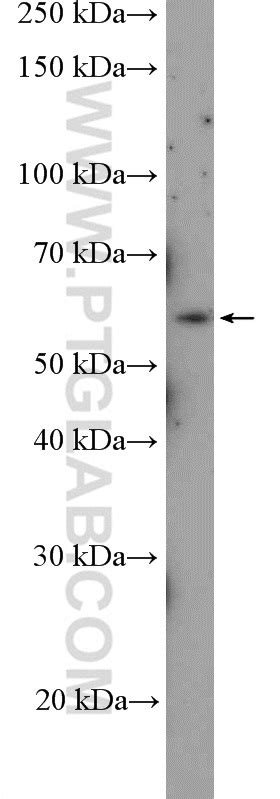 Abi1 Antibody 27387 1 Ap Proteintech