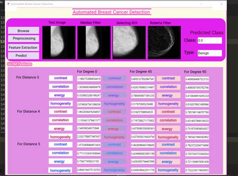 Github Sleepyrizi Breastcancerdetection An Cad System To Preprocess