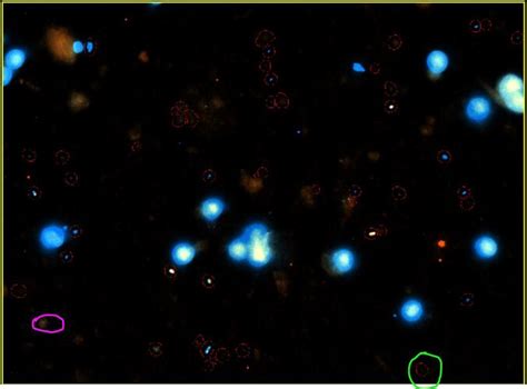 Cell Detection Issues In Qupath Image Analysis Image Sc Forum