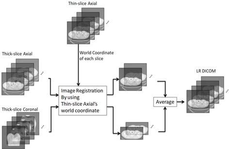 Process Flow For Generating Lr Dicom Data From Right To Left Of The