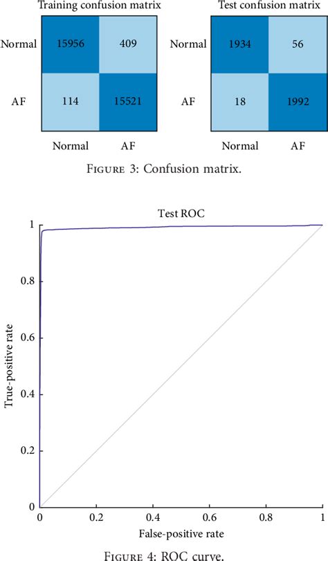 Figure 1 From Automated Classification Of Atrial Fibrillation Using Artificial Neural Network