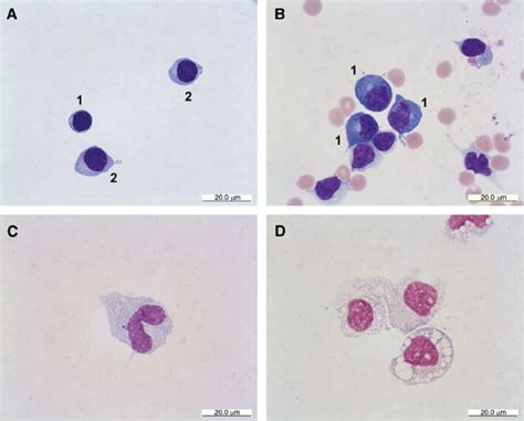 Cell Populations Of A Normal And Activated Csf Cell Picture A Normal